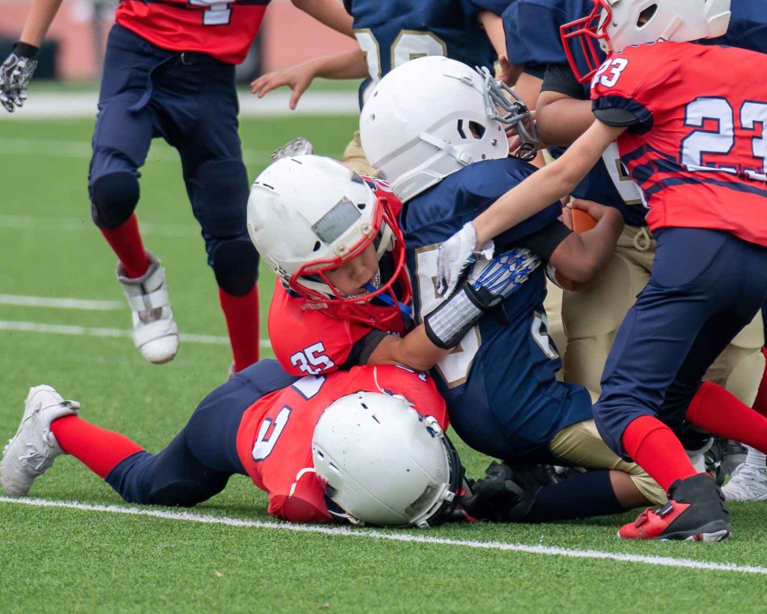 First Aid for Concussions: Response and Treatment
