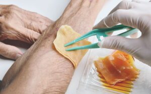 Injury Cleaning: Iodine vs. Neosporin - Which is Better?