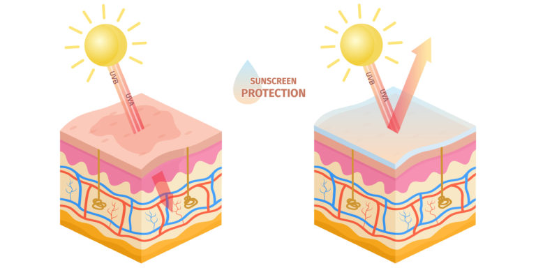 How to Prevent and Treat Sunburn - Protect Your Skin!