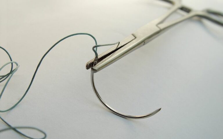 Surgical Staples vs Stitches - Pros and Cons!