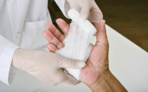 How to Use a Burn Dressing - Proper Application!