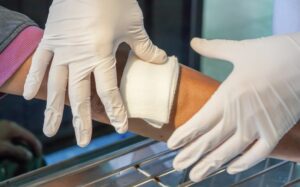 How to Use a Burn Dressing - Proper Application!