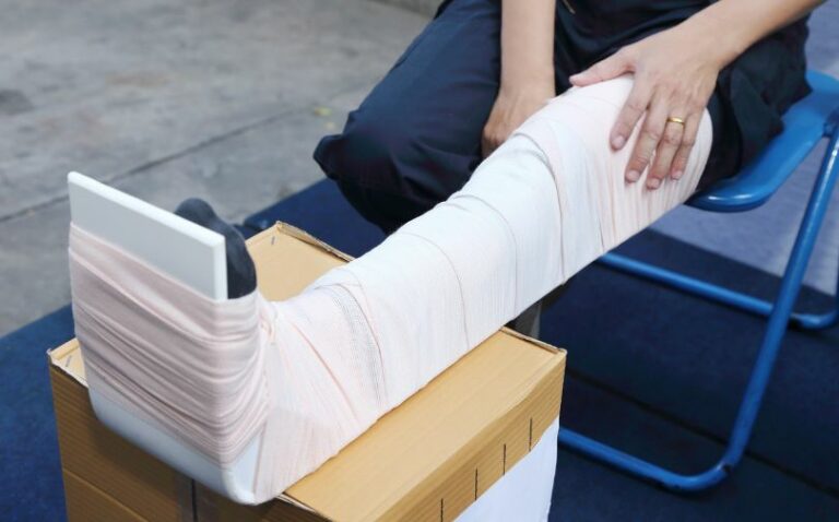 First Aid for a Broken Bone and Fractures - Essential Steps!
